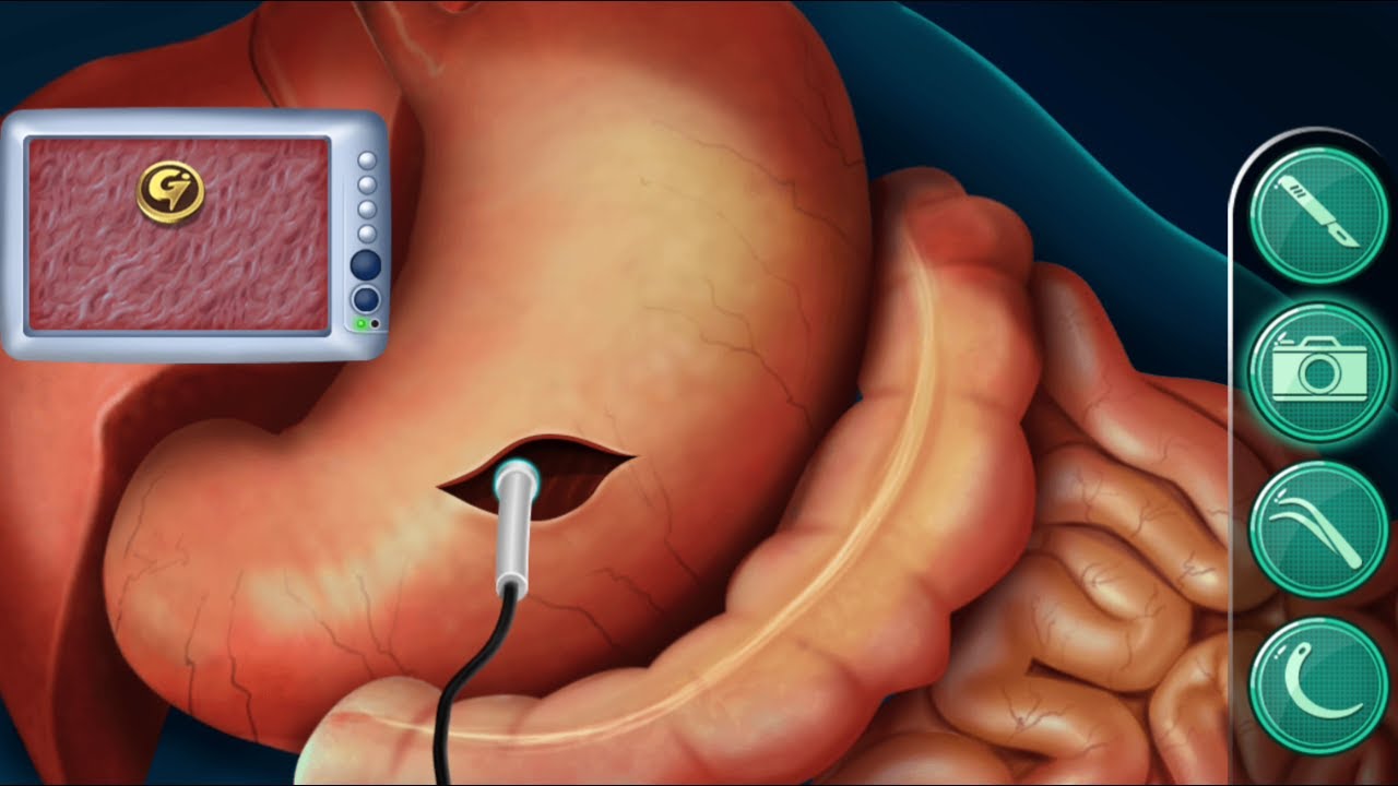 Game operasi tangan /tangan/game operasi bedah/han Surgery/stomach ...