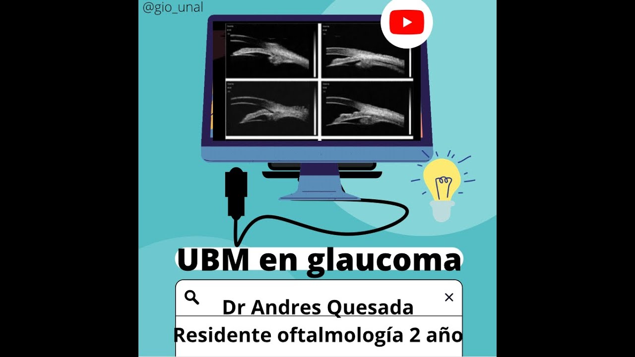 UBM EN GLAUCOMA- Dr Andres Quesada - YouTube