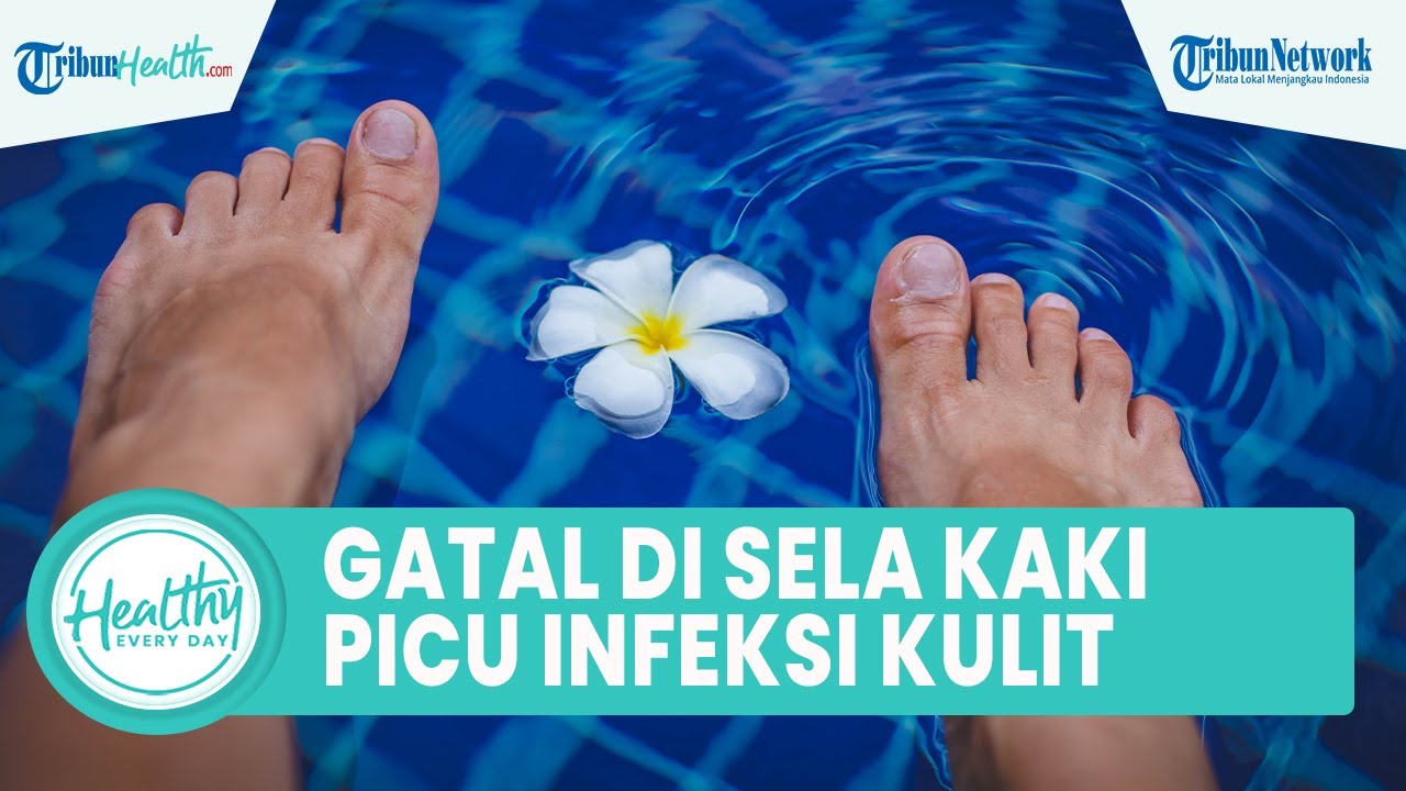 Apakah Gatal di Sela Jari Kaki Bisa Picu Infeksi Kulit? Inilah 3 Jenis ...