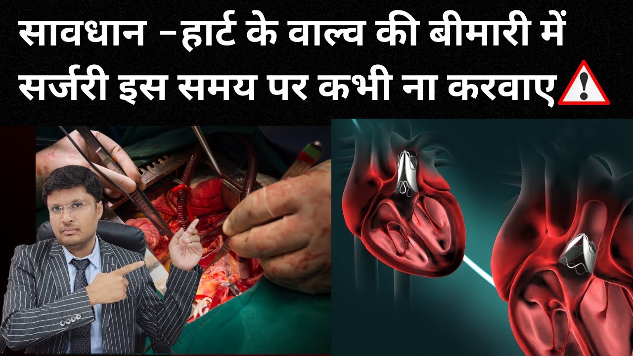 TIMING OF SURGERY FOR HEART VALVE DISEASE - YouTube