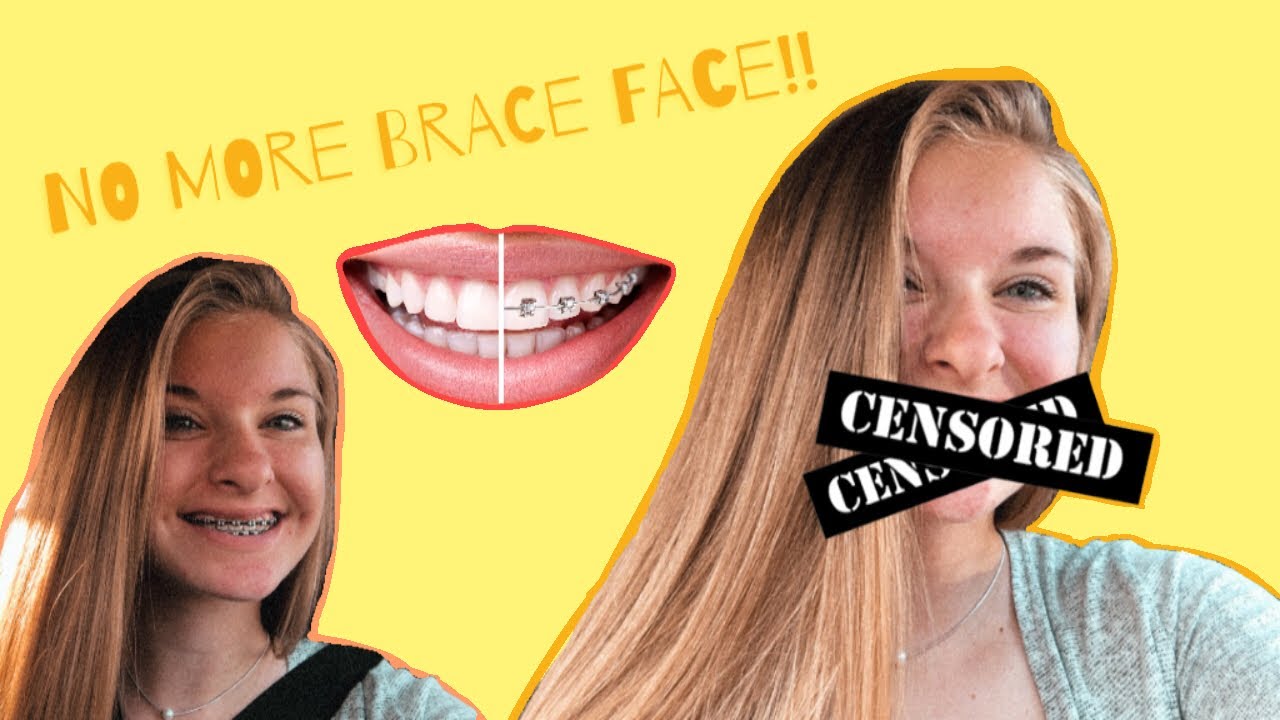 I GOT MY BRACES OFF!! + high school outfit haul - YouTube