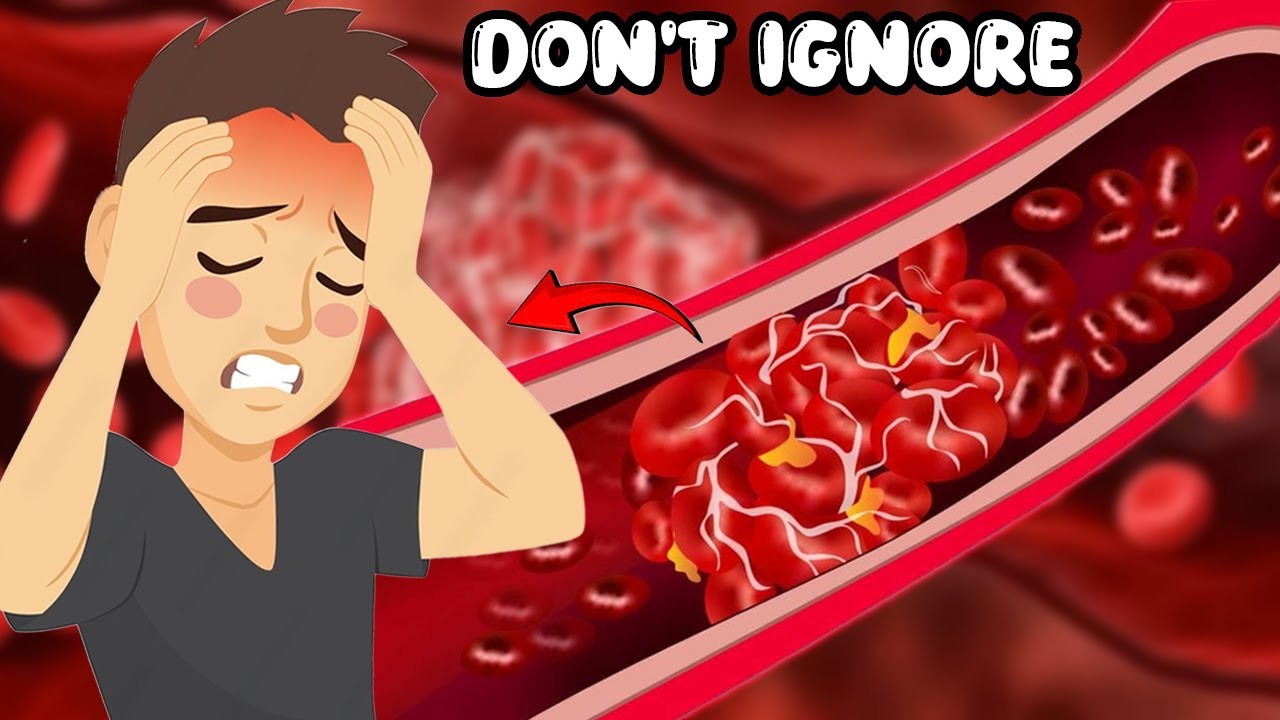 8 Critical Warning Signs of Blood Clots You Shouldn't Ignore (Red Flags ...