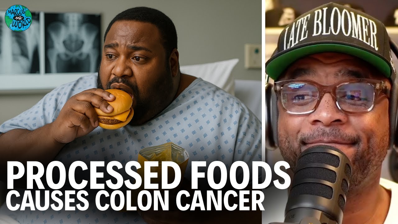 PROCESSED FOODS CAUSES COLON CANCER.. study found colon cancer as early ...
