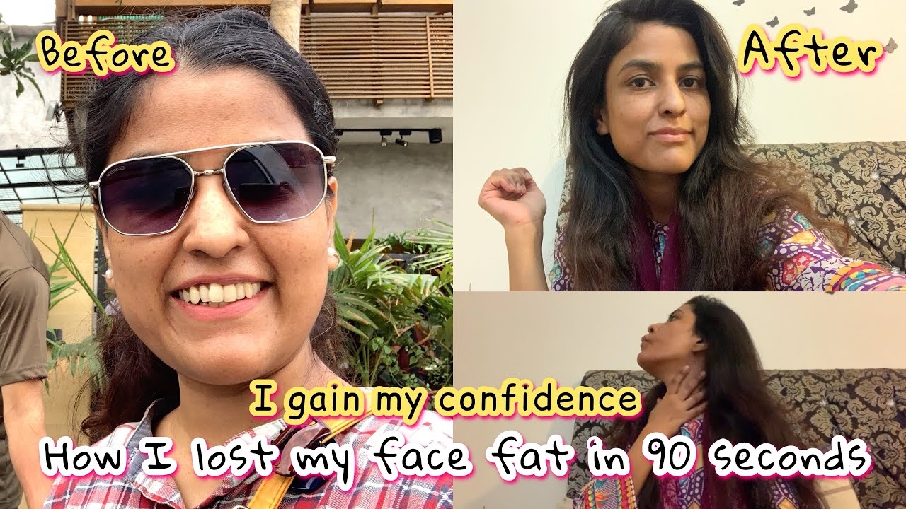 How I Lose Face Fat in 90 Seconds | Double chin gone | Jaw line visible ...