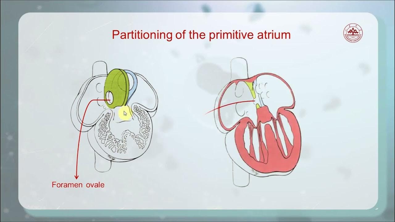 8 2 Partitioning of the primitive atrium 齐鲁医学院 - YouTube
