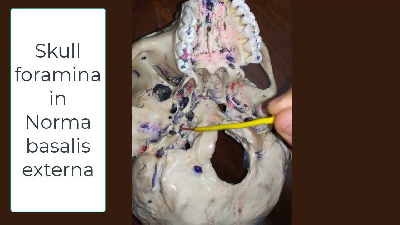 skull foramina in norma basalis externa (in 1 min) - YouTube