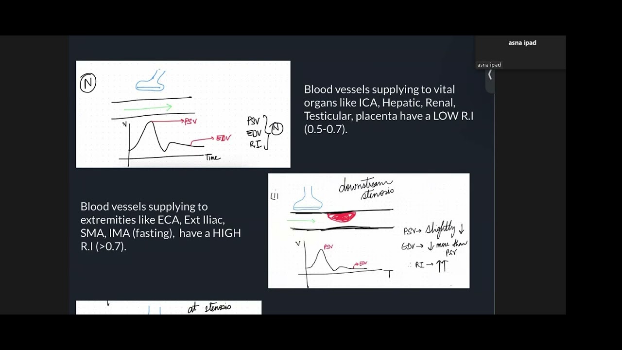 Doppler Ultrasound in Obstetrics by Dr Asna Hashmi, Radiology Post ...