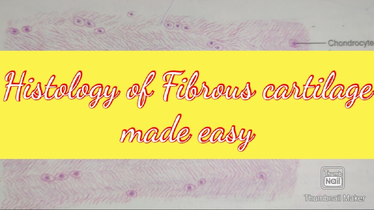 Histology of Fibrous cartilage; 1st BDS anatomy - YouTube