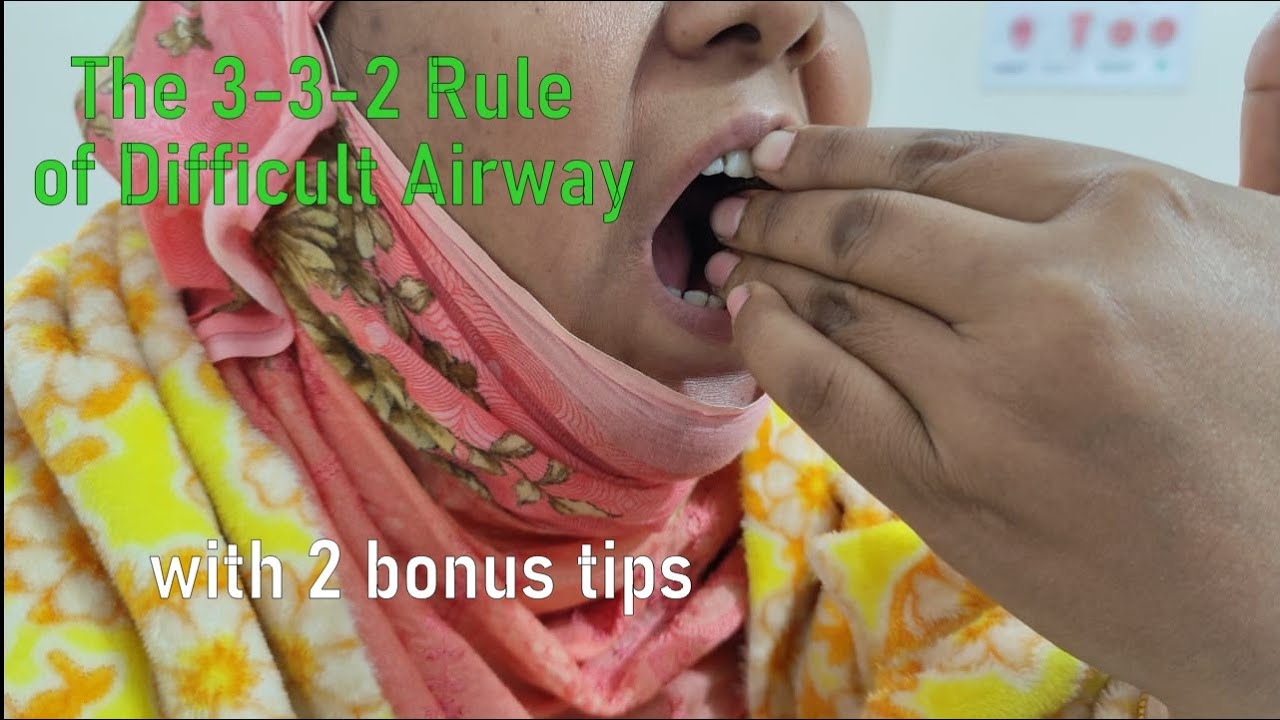 The 3 3 2 Rule Of Difficult Airway Assesment YouTube The 3 3 2 Rule Of Difficult Airway Assesment YouTube