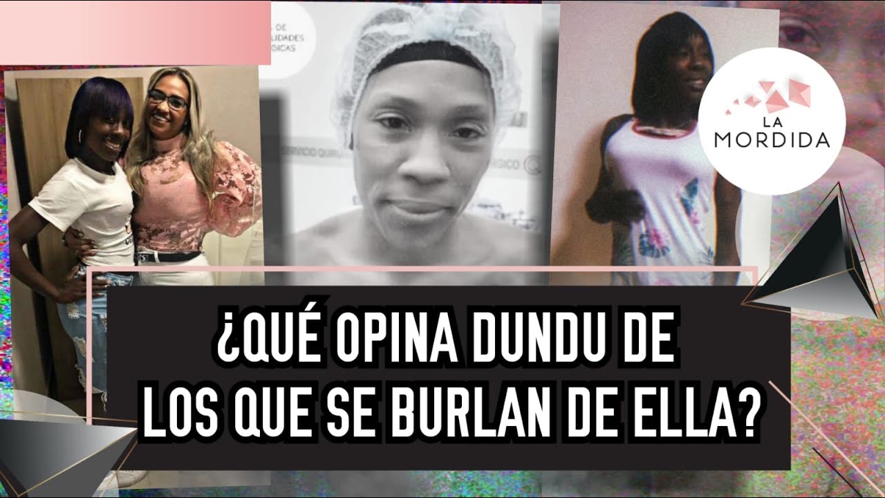 OYE LA MORDIDA | DUNDUNSUA HABLA DESPUÉS DE SU POLÉMICA OPERACION DE ...