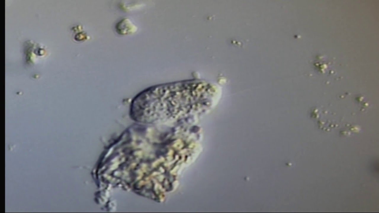 CERCOMONAS FLAGELADO - YouTube