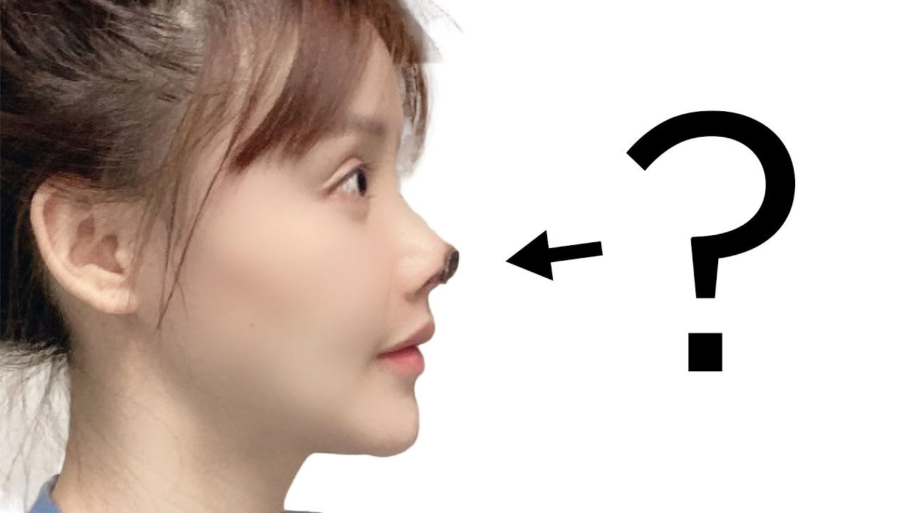 What happened to Gao Liu’s nose? - YouTube