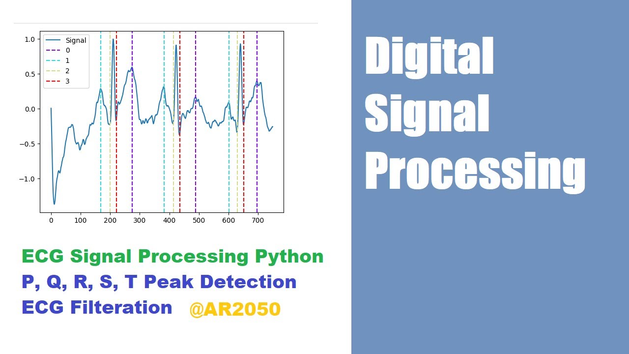 Ecg Processing In Python With Neurokit2 For Ecg Signal Cleaning And P Q R S T Wave Peaks