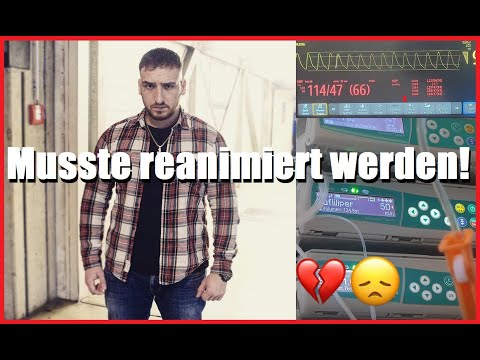 SeroDix kurzer Herzstillstand nach unregelmäßigen Herzzschlägen - YouTube