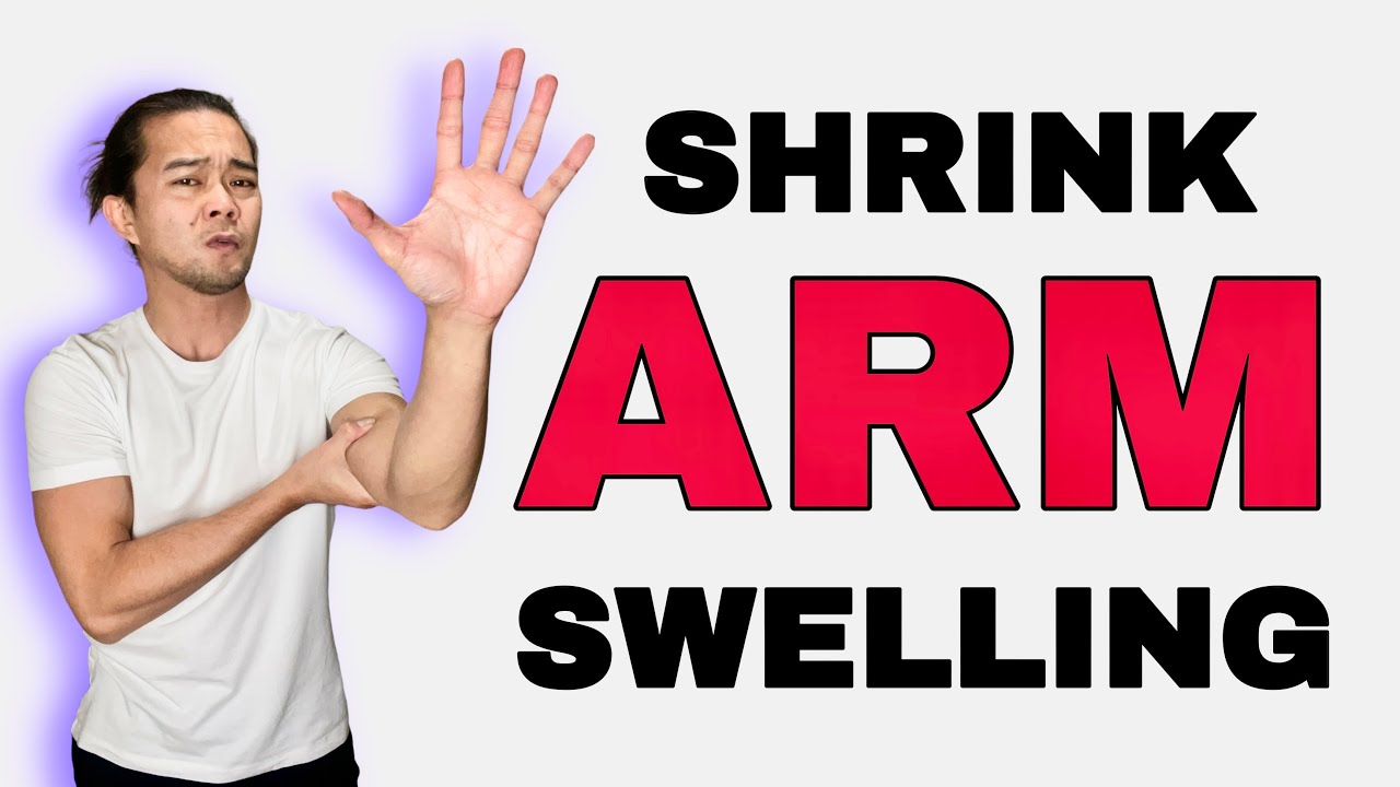 Lymphedema Management: Effective Exercises for Arm Swelling Reduction ...