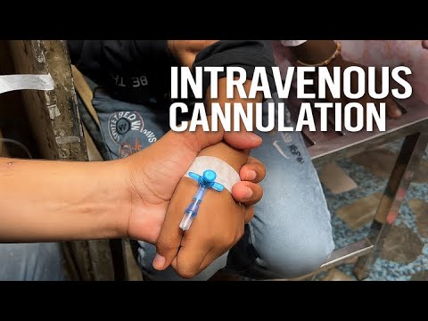 Intravenous Cannulation | IV Line कैसे लगाएं Step by Step | iv ...