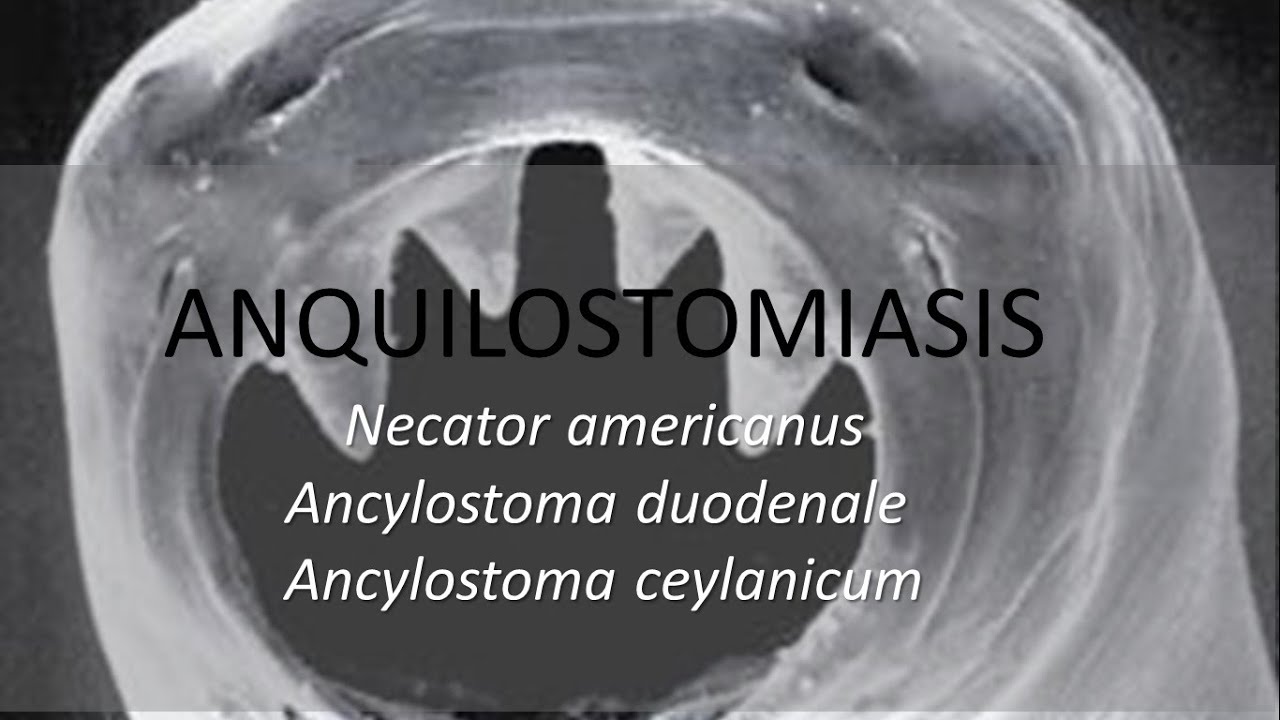 TEMA 3: Anquilostomiasis. Epidemiología, prevención y control - YouTube