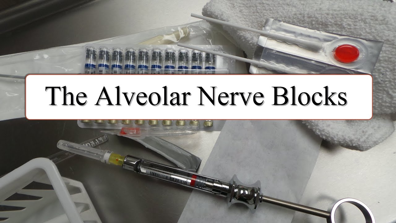 The Alveolar Nerve Blocks - YouTube