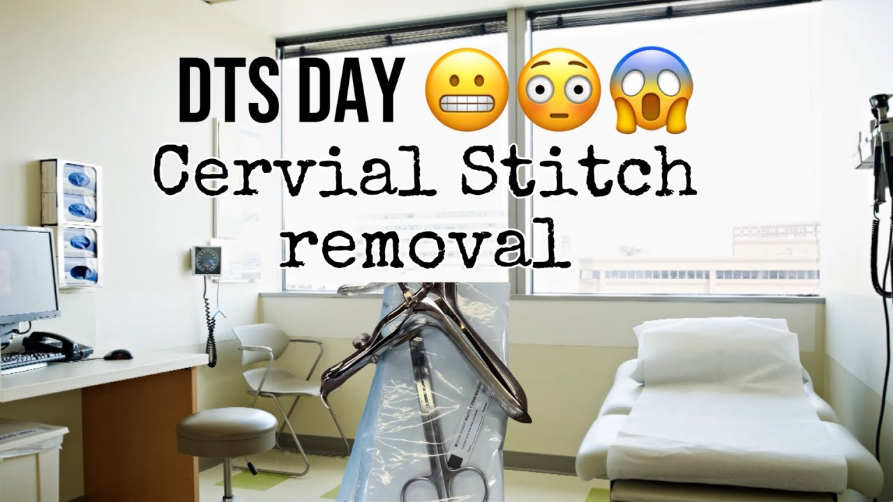 Cerclage Removal* I Ditch the stitch 🥹*Incompentent Cervix - YouTube