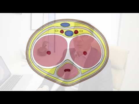 CALIBRE Medical Male Enhancement: Part 2