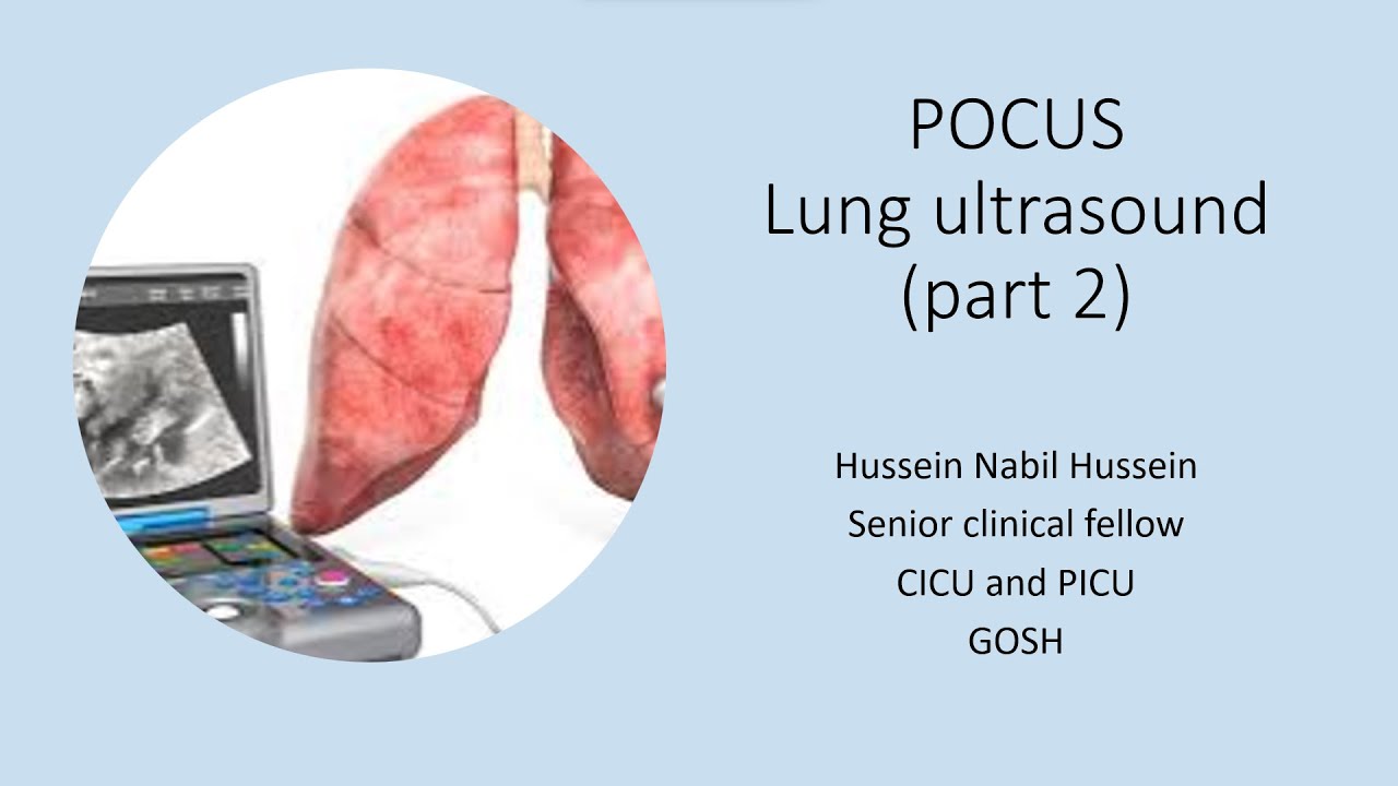 POCUS, Lung ultrasound ( lung pathologies) - YouTube