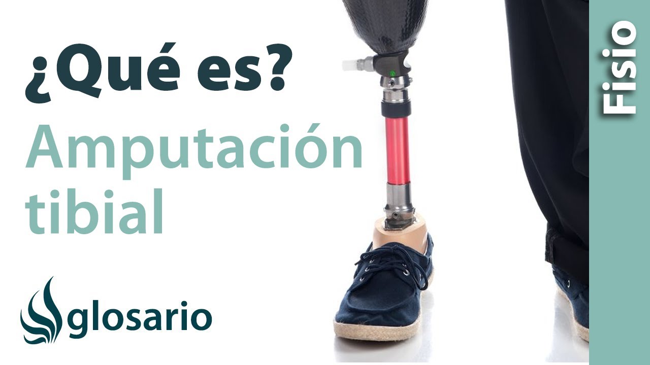 AMPUTACIÓN TIBIAL | ¿Qué es? - YouTube