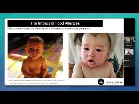 Food Allergy 101: Food Allergy Testing Basics - YouTube