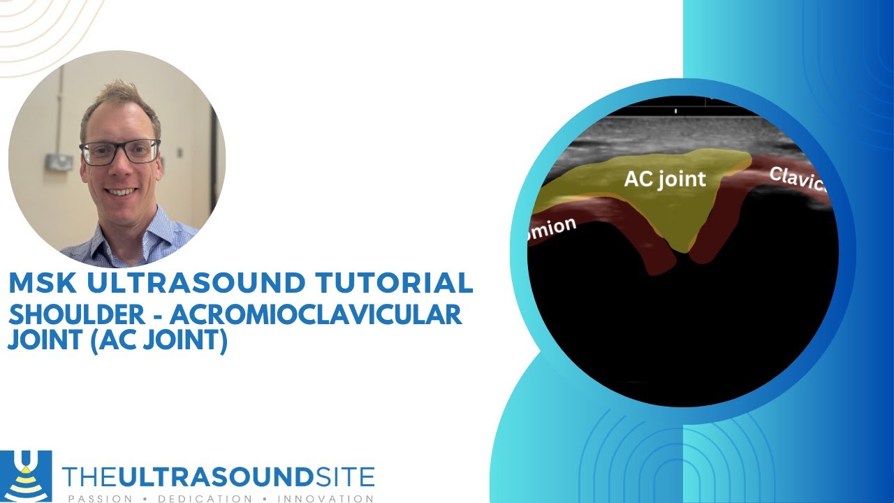Ultrasound evaluation of the AC joint - YouTube