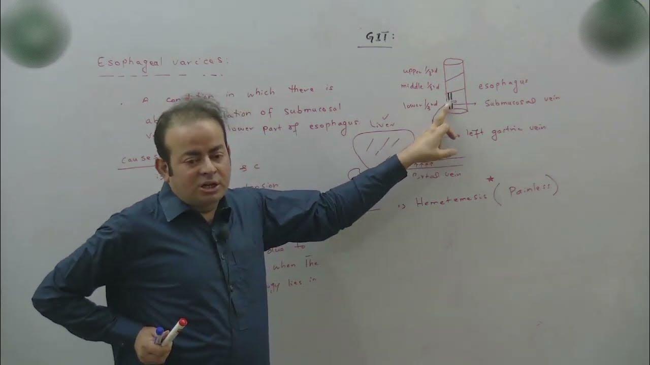Esophageal Varices, Plummer Vinson Syndrome & Barret Esophagus (GIT ...