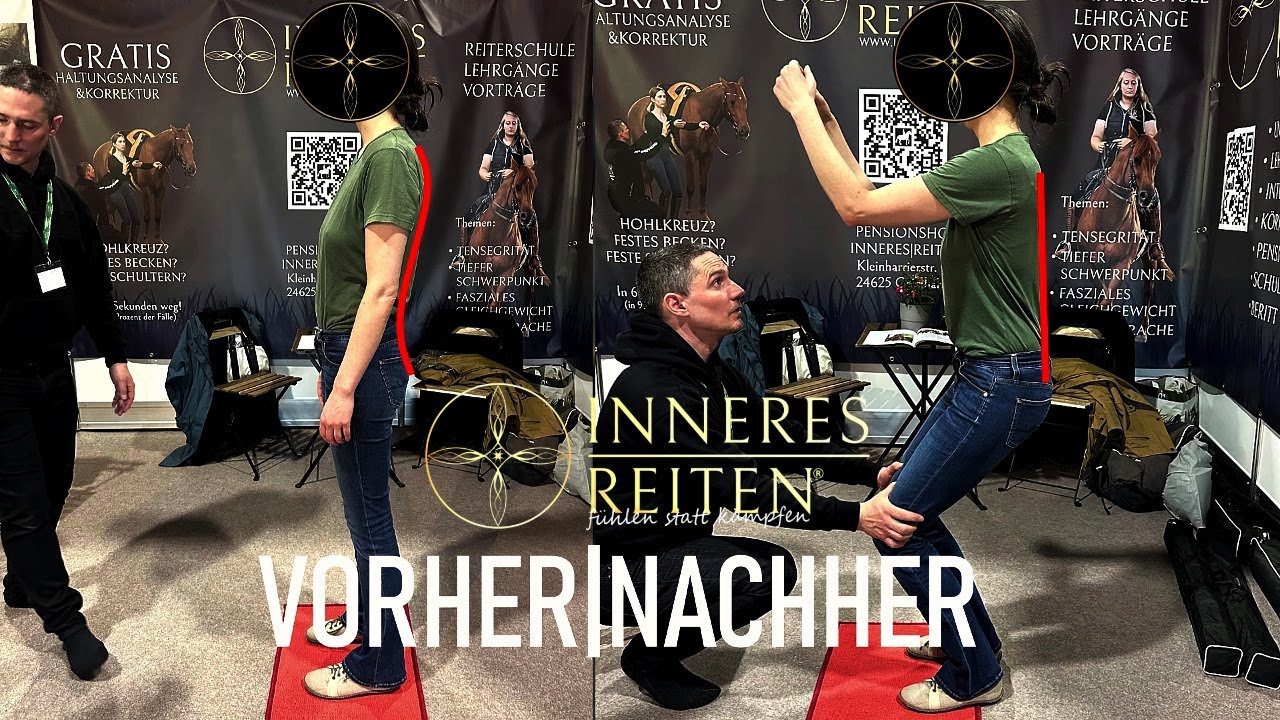 Hohlkreuz Wegtrainieren Vorher Nachher