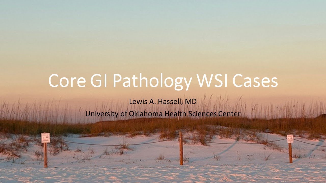 High Yield GI Path for Boards - YouTube