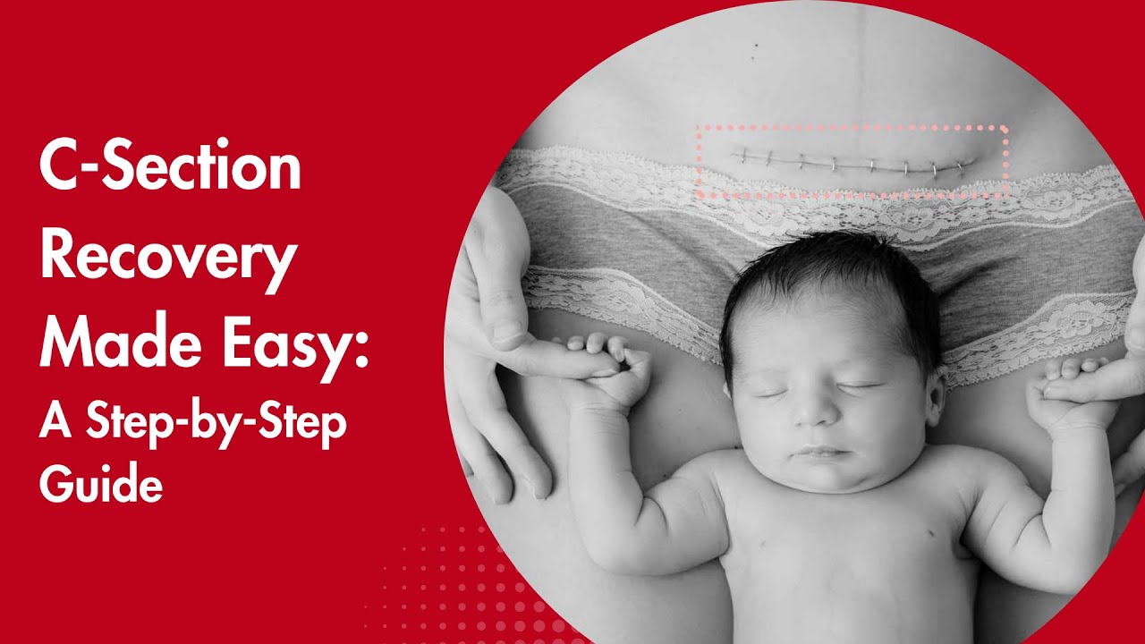 🌟 C-Section Recovery Made Easy: A Step-by-Step Guide 🌟 - YouTube