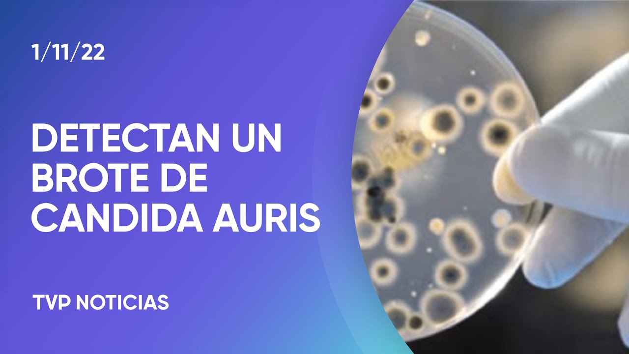 Detectan el primer brote de candida auris en el país - YouTube