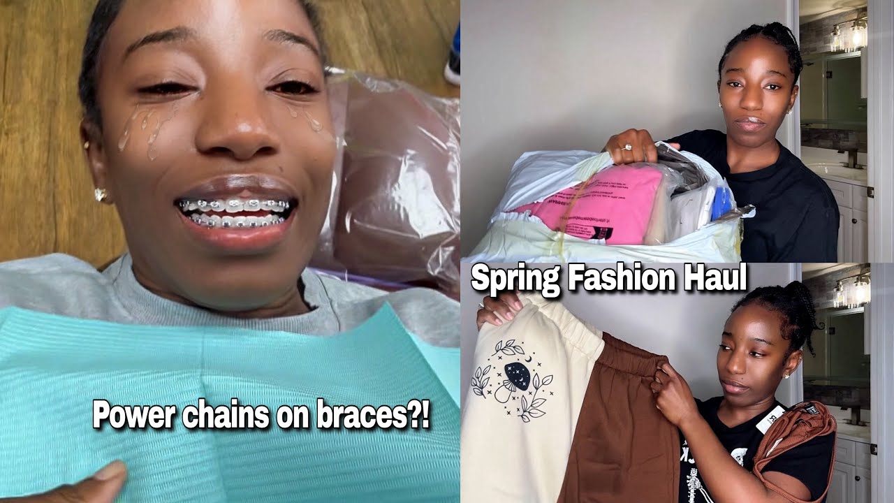 Finally Getting POWER CHAINS On My Braces?! | Spring Fashion Haul Ft ...