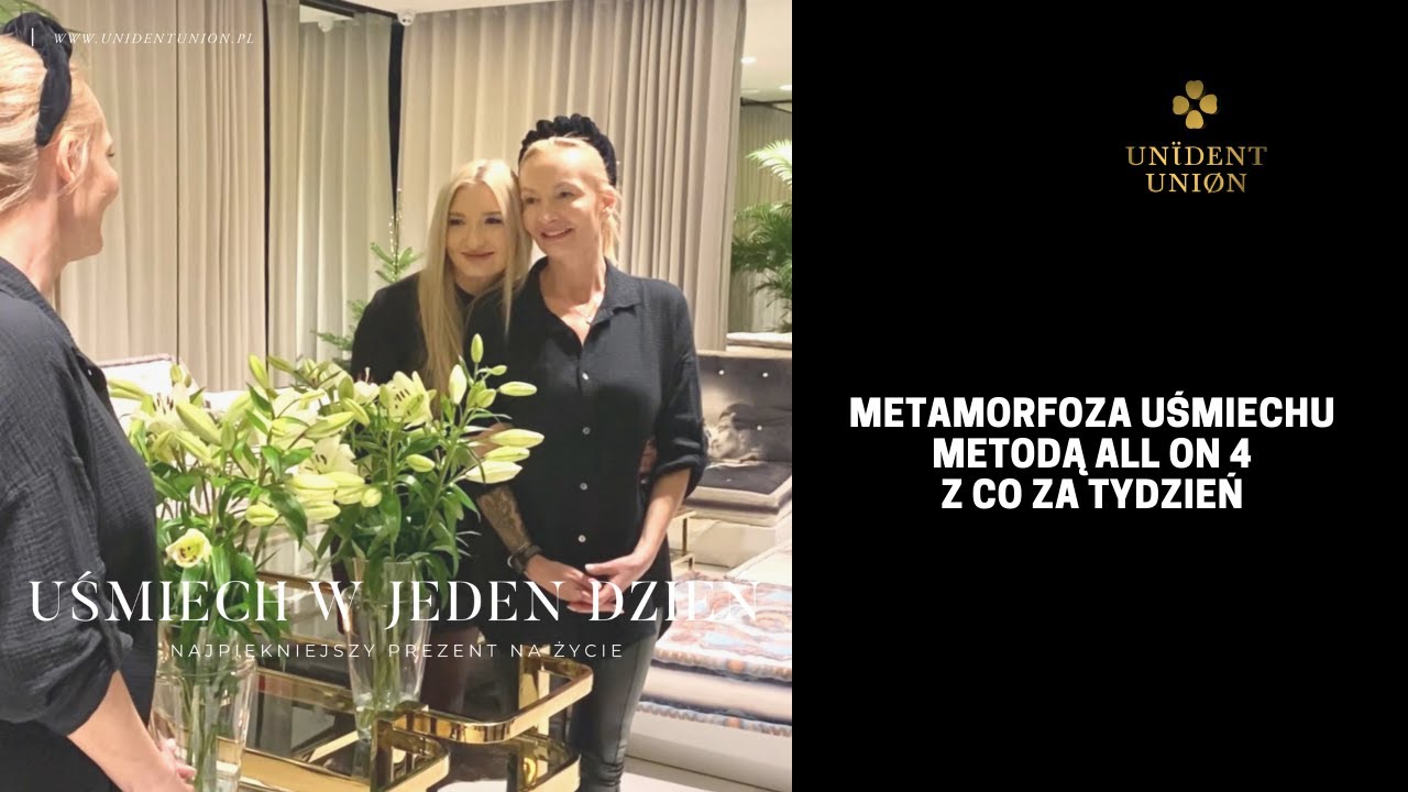 UNIDENT UNION ALL ON 4 WYWIAD - YouTube