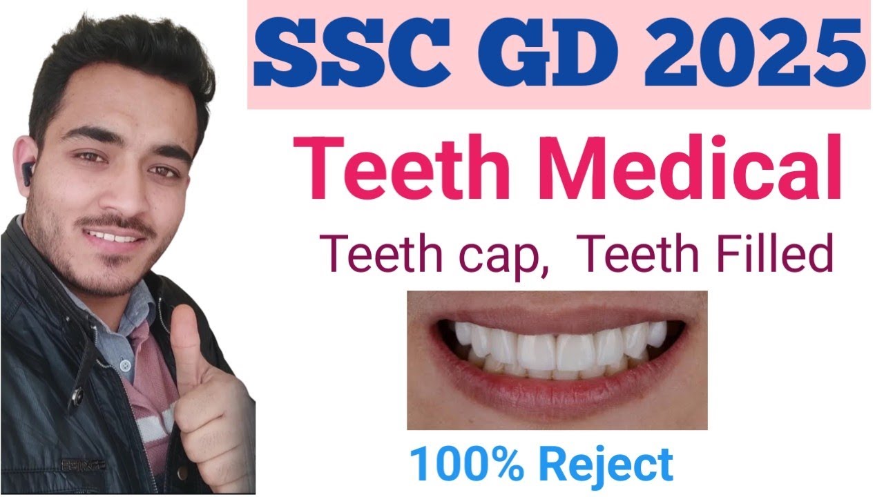 Ssc gd teeth medical test|| CPO, SSC GD , Other Capf posts. - YouTube