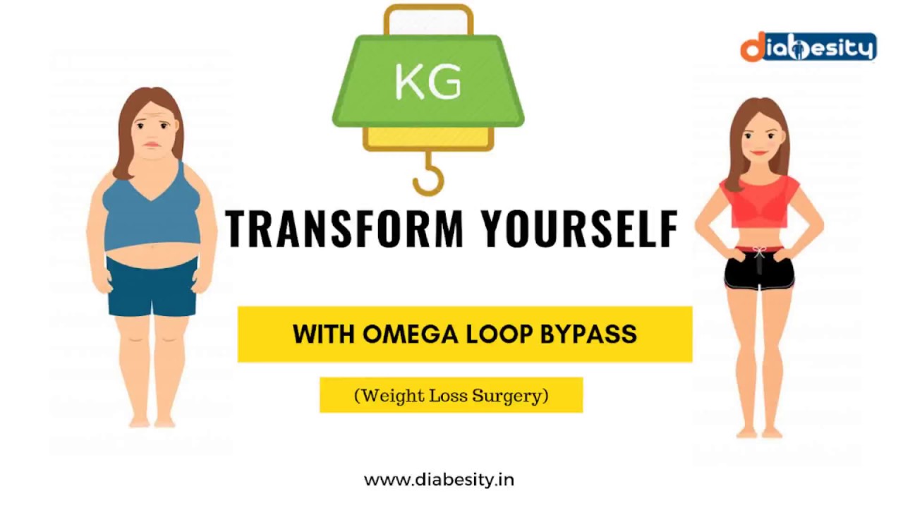 Omega Loop Bypass In New Delhi | Weight Loss Procedure | Bariatric ...