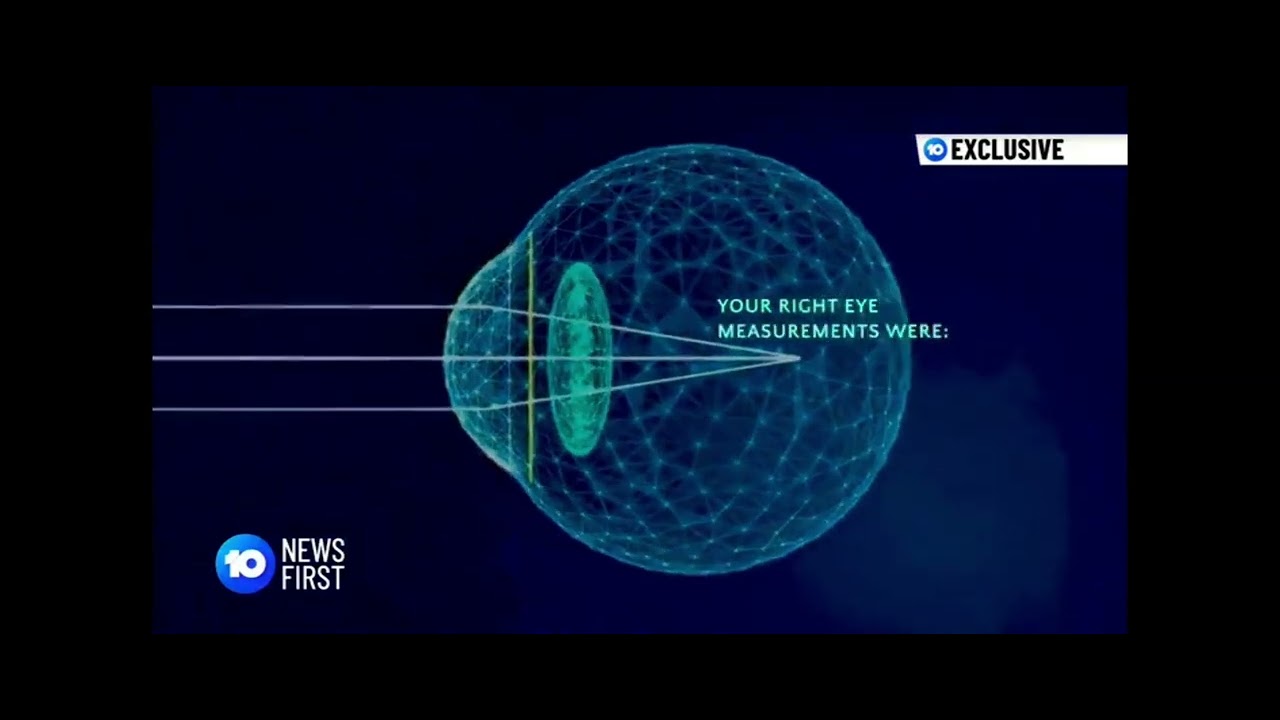 Channel 10 NEWS report on Wavelight Plus - YouTube