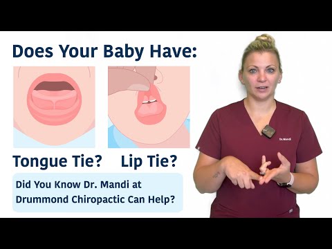 Does your baby have tongue tie? Lip Tie? Difficulty Nursing?