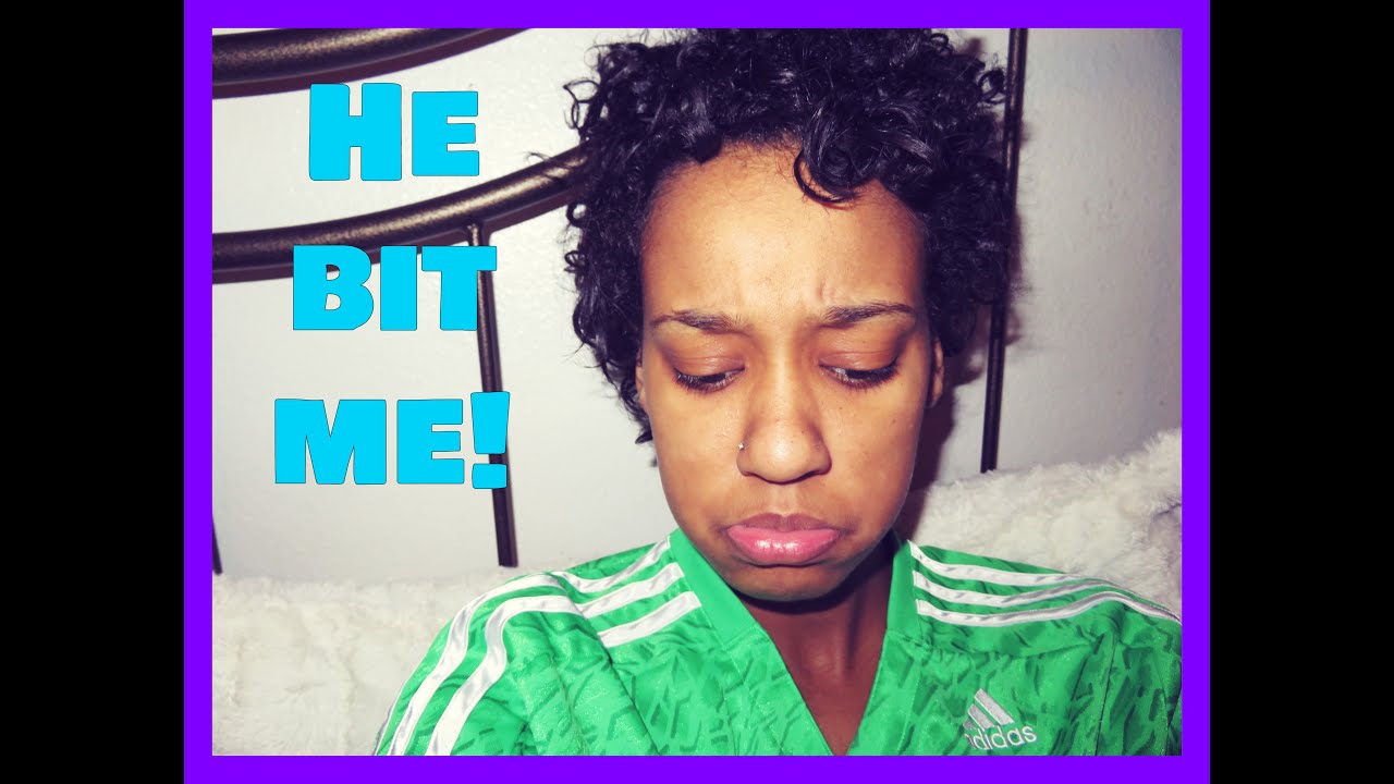 He Bit Me! //Vlog 7 - YouTube