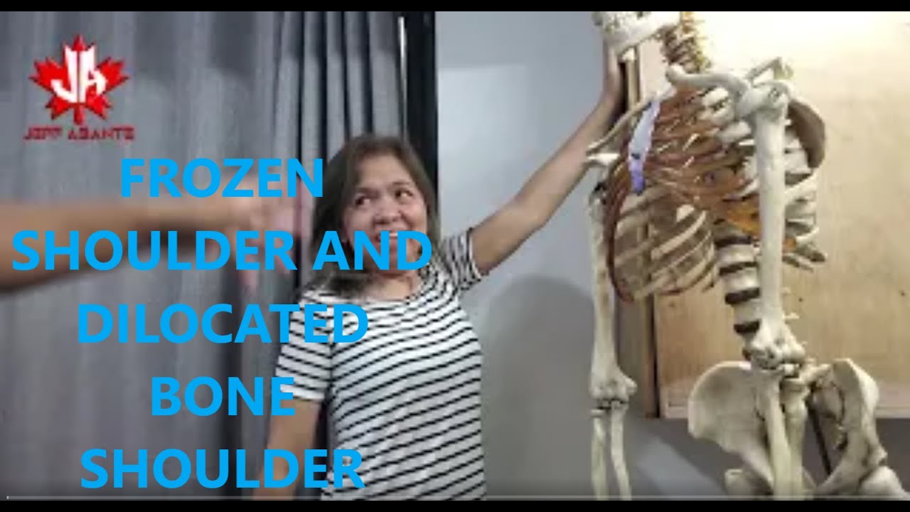 FROZEN SHOULDER AND DISLOCATED BONE SHOULDER PROBLEM FIX BY 3M TIT TAR ...