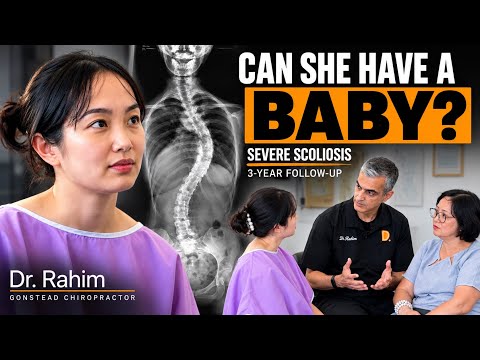 Can You Have a Healthy Pregnancy With Severe Scoliosis? | 3-Year Follow-Up | Dr. Rahim