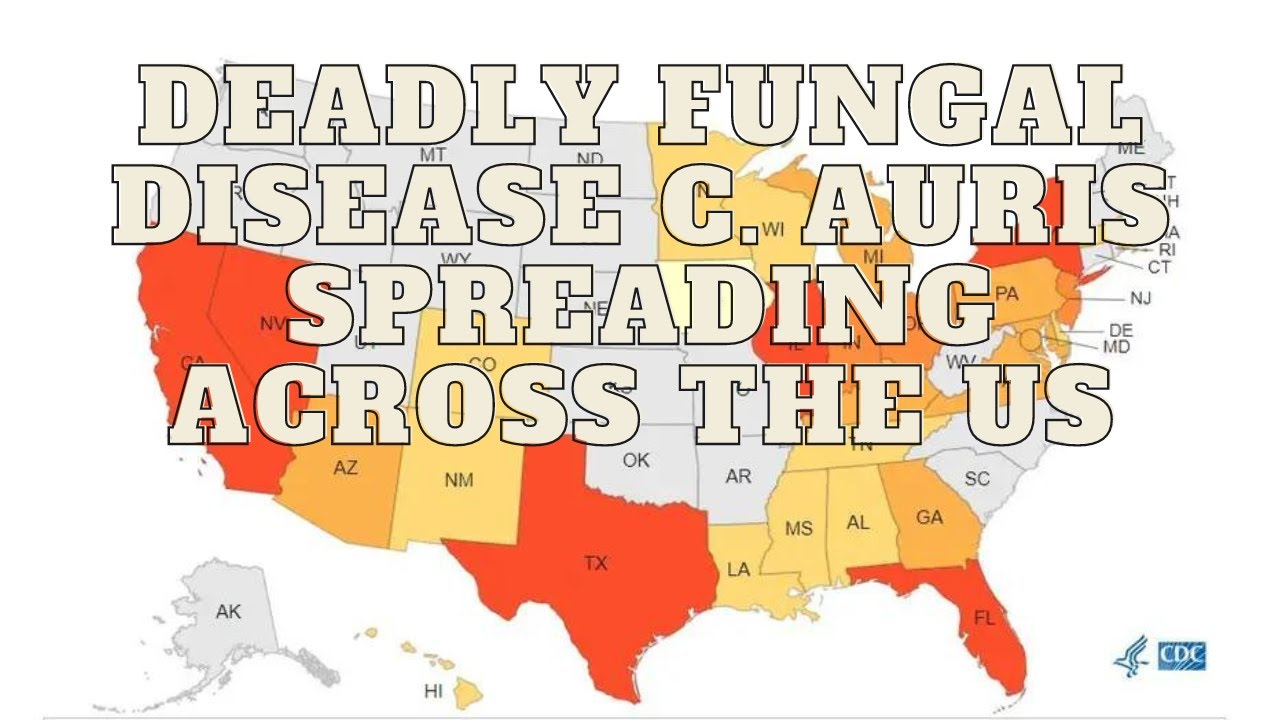 Deadly Fungal Disease C. Auris Spreading Across the U.S - YouTube