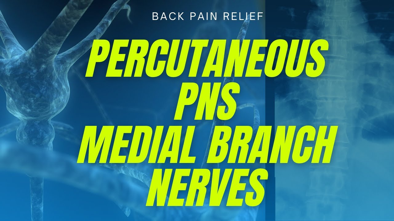 Percutaneous PNS of the Medial Branch Nerves : Cutting Edge Treatment ...