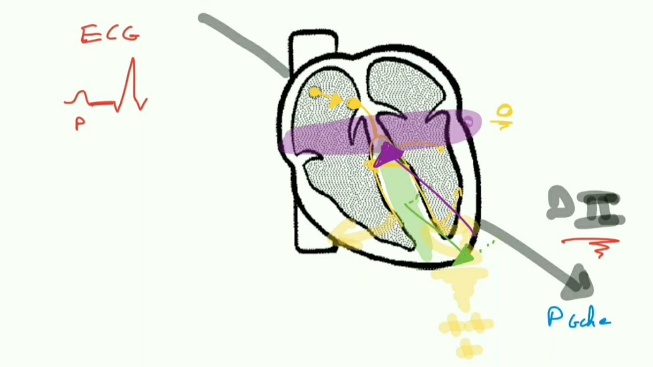 Maîtriser l'ECG en 2 heures - YouTube