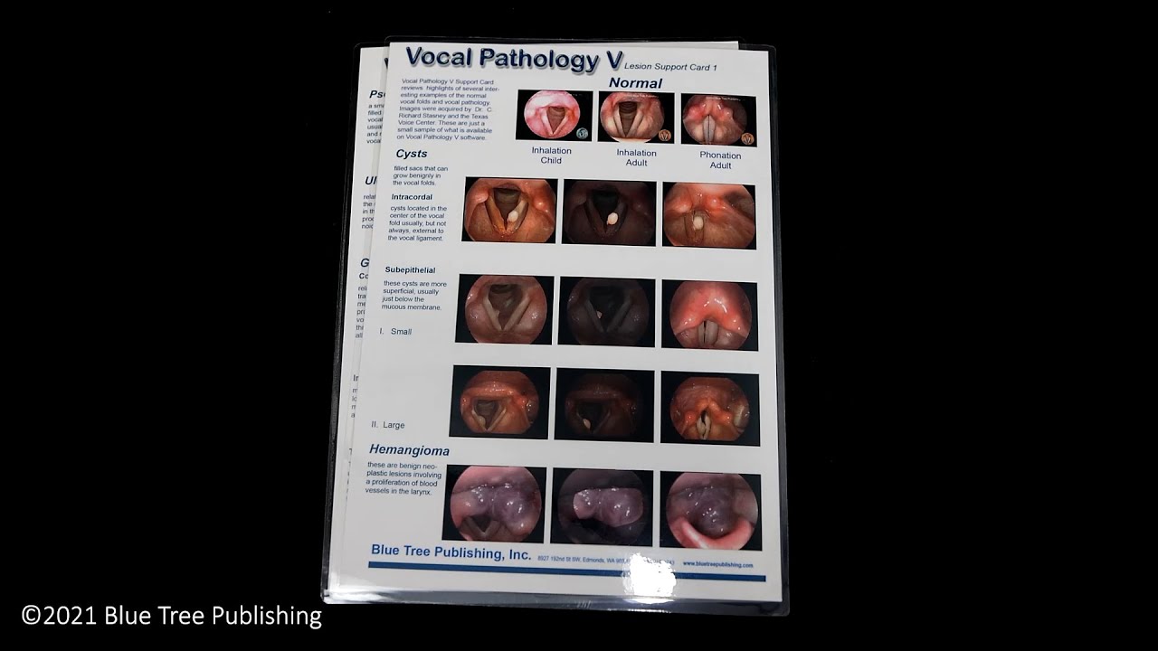 Vocal Pathology V Anatomical Chart - YouTube