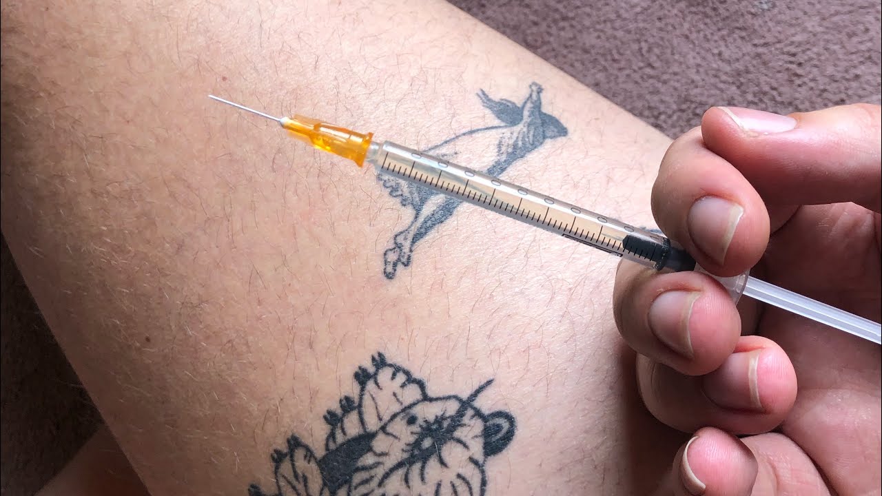 5 months in HRT | inyección intramuscular de estradiol valerato - YouTube