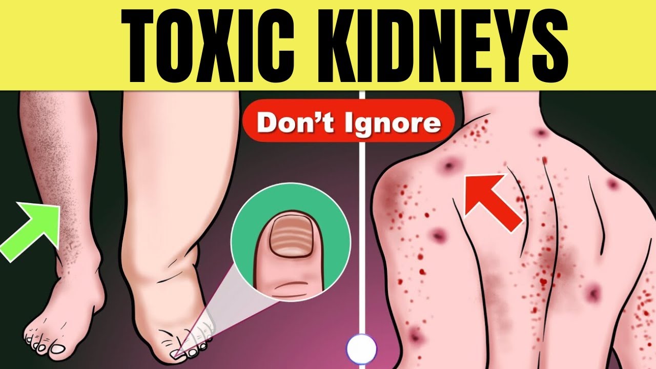 Top 5 Warning Signs That Your Kidneys Are Toxic - YouTube