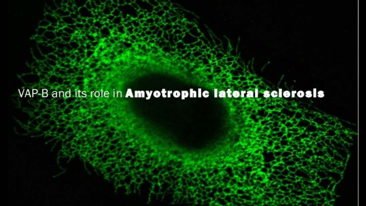 Sima Lev: VAP-B and its role in Amyotrophic lateral sclerosis - YouTube