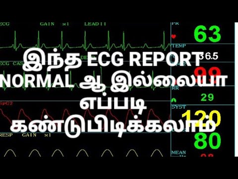 ECG learning for beginners - YouTube